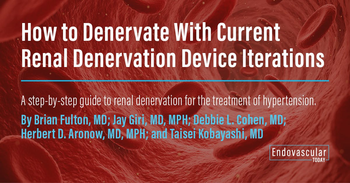 How to Denervate With Current Renal Denervation Device Iterations - Endovascular Today